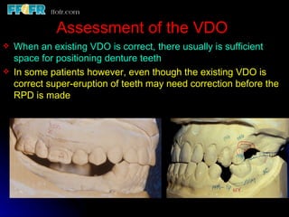 10.maxillo mandibular records | PPT