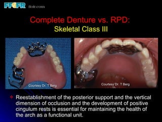 10.maxillo mandibular records | PPT