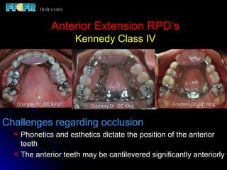 10.maxillo mandibular records | PPT