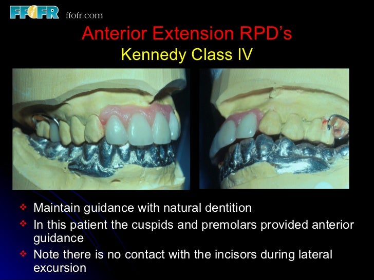 10.maxillo mandibular records