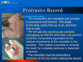 10.maxillomandibular relation records | PPT