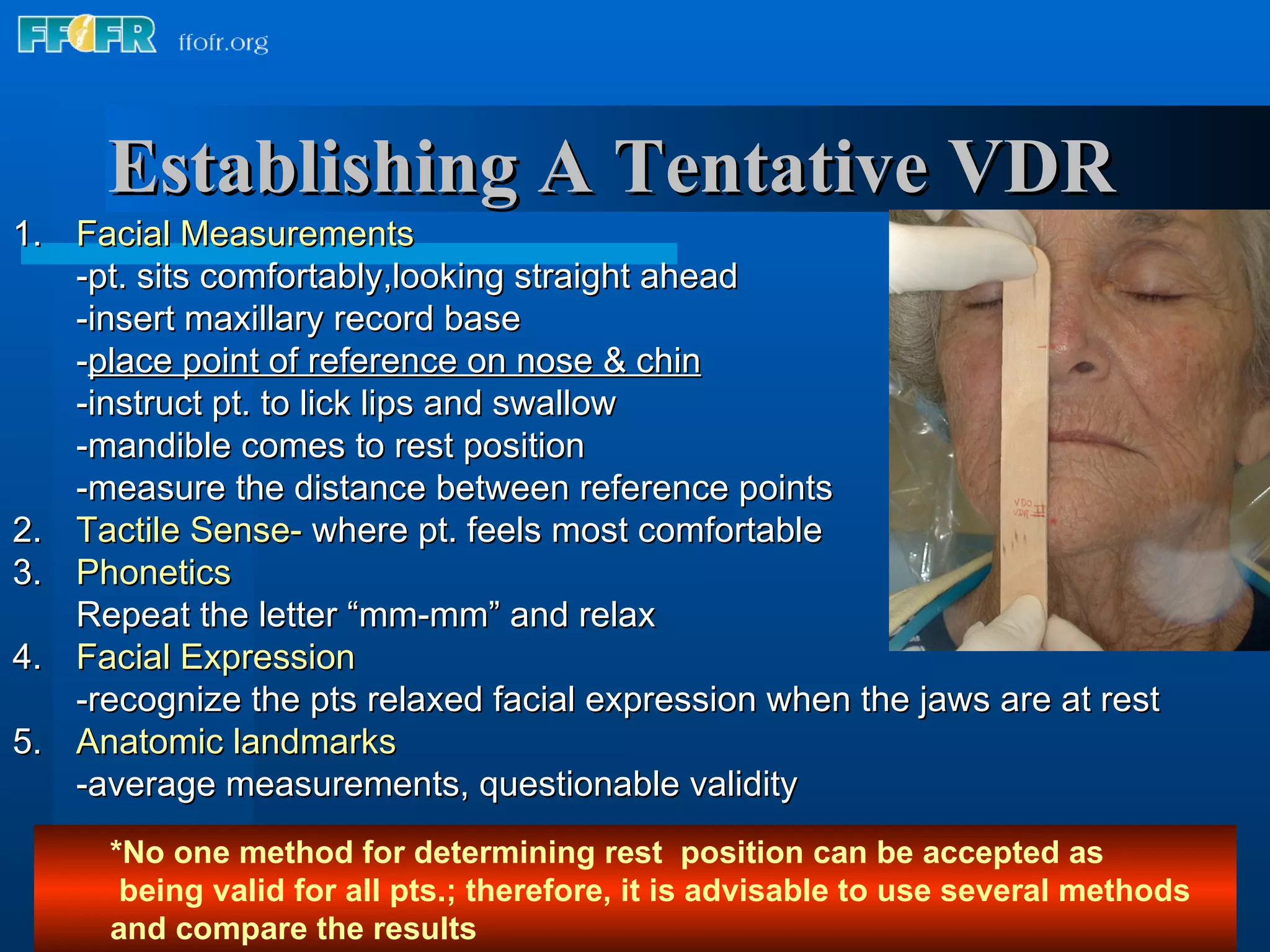 10.maxillomandibular relation records | PPT