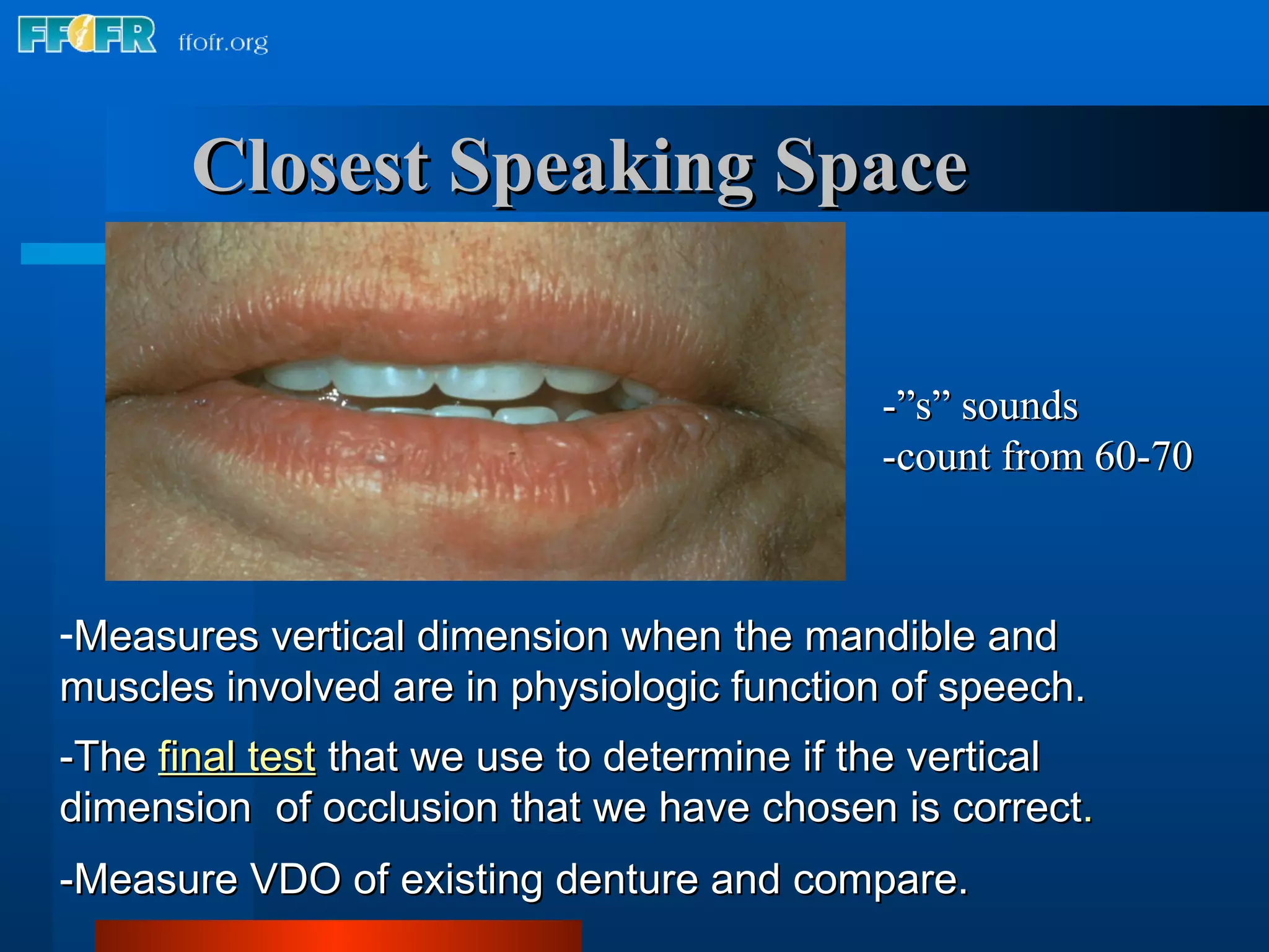 10.maxillomandibular relation records | PPT