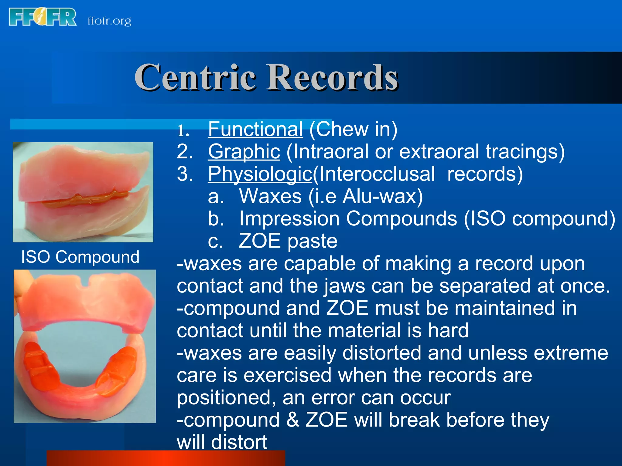10.maxillomandibular relation records | PPT
