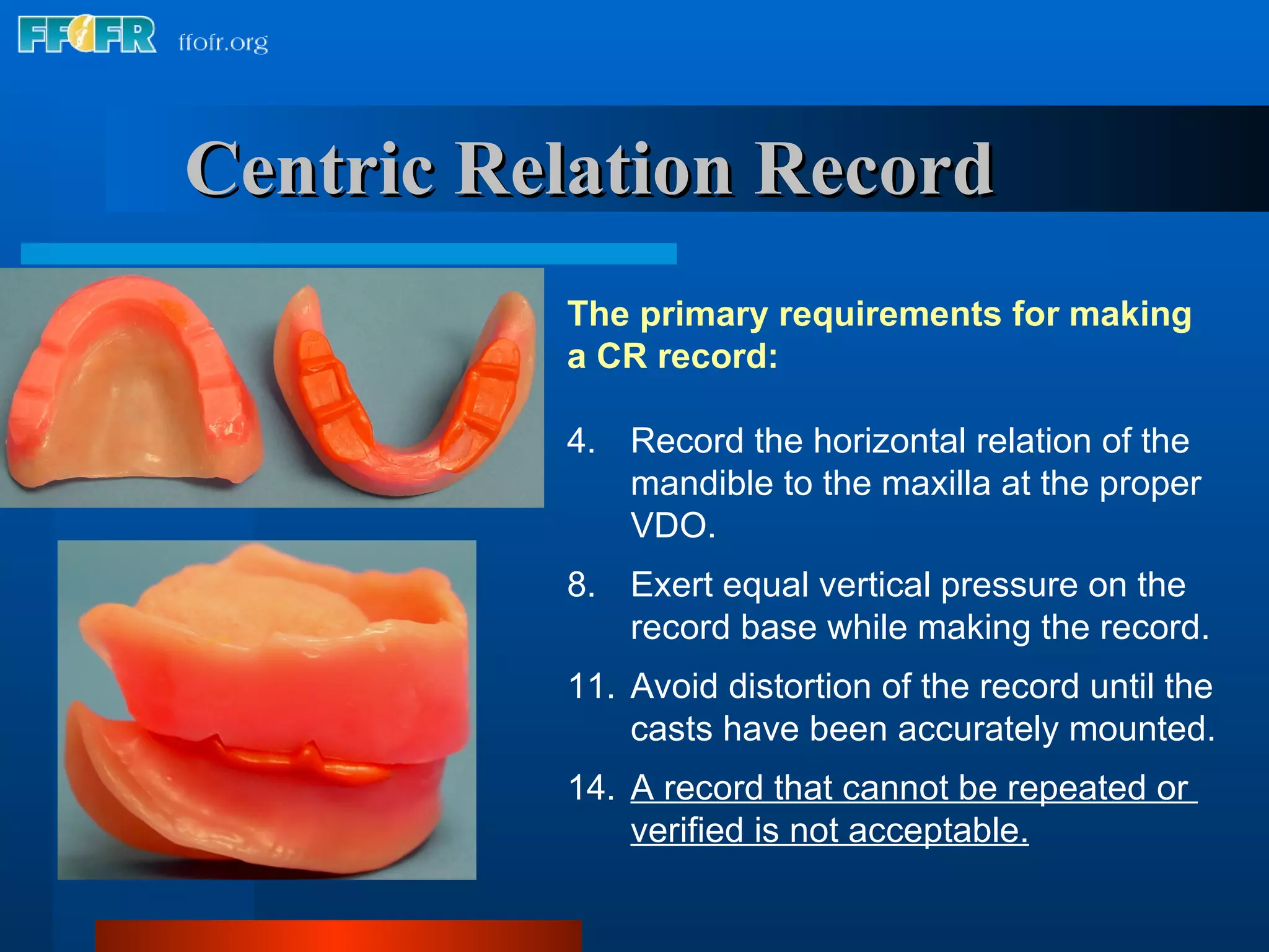 10.maxillomandibular relation records | PPT