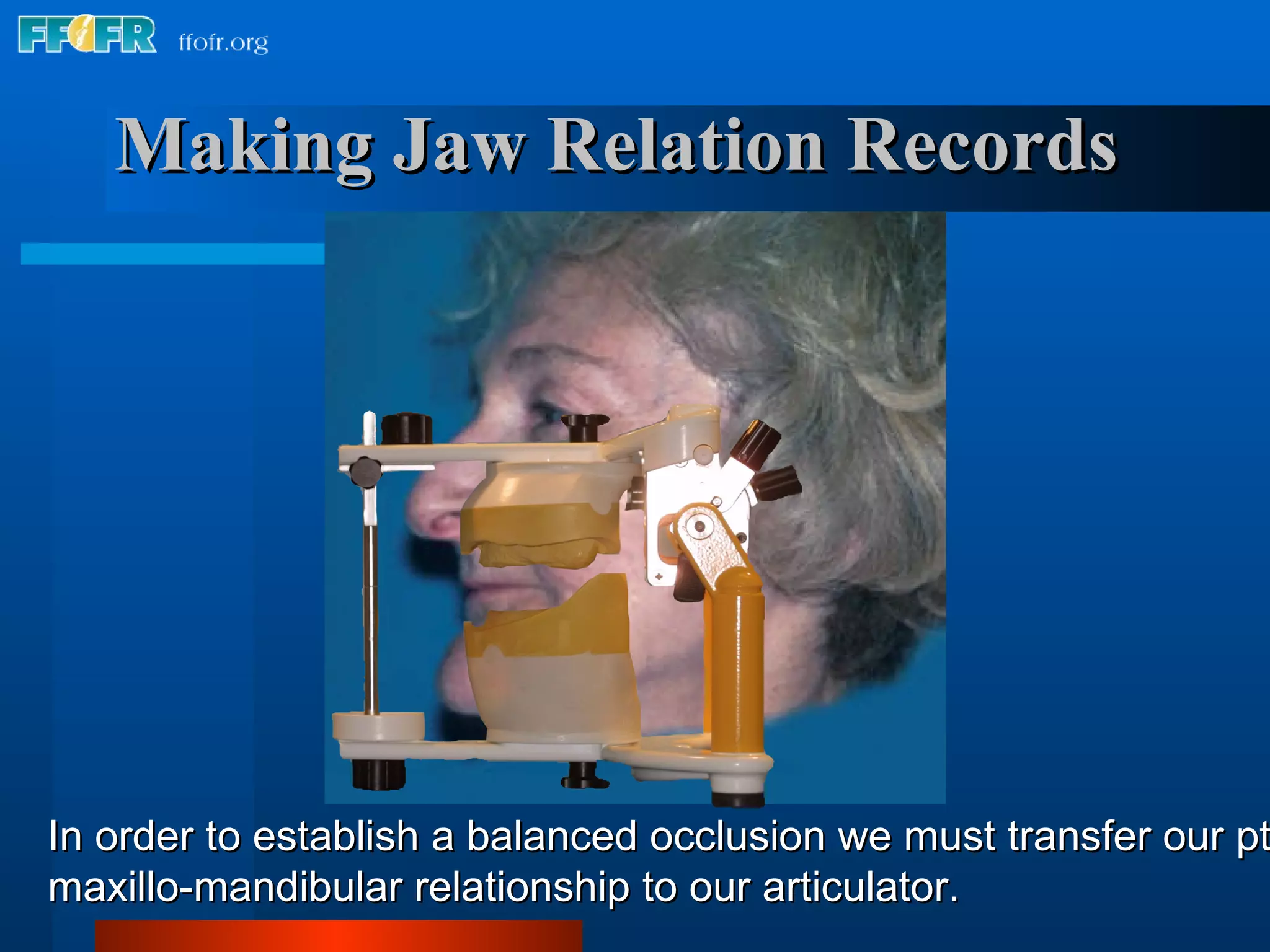 10.maxillomandibular relation records | PPT