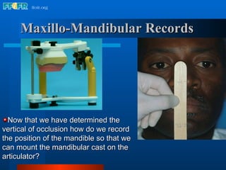 10.maxillomandibular relation records | PPT