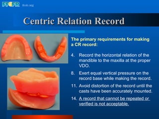 10.maxillomandibular relation records | PPT