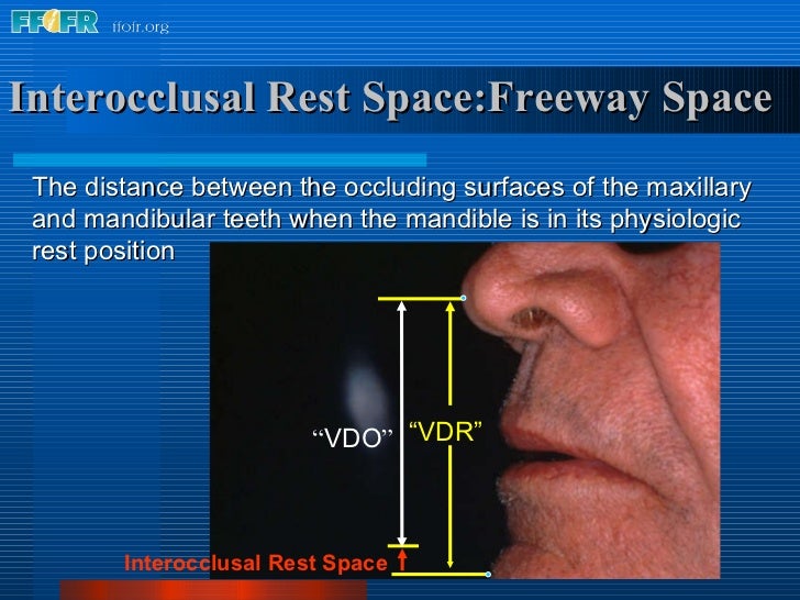 10.maxillomandibular relation records