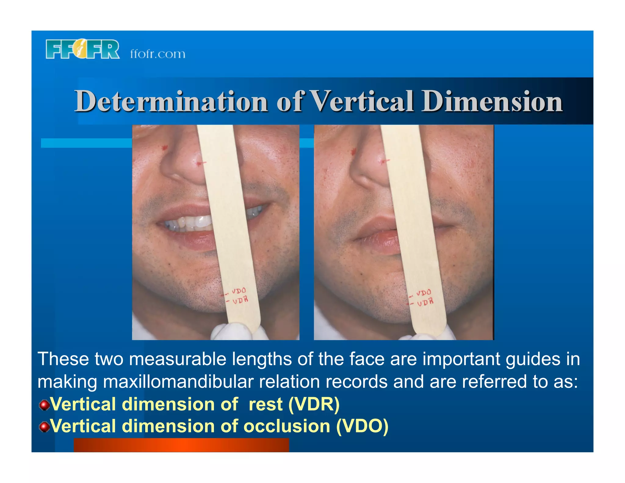 10.maxillomandibular relation records | PDF