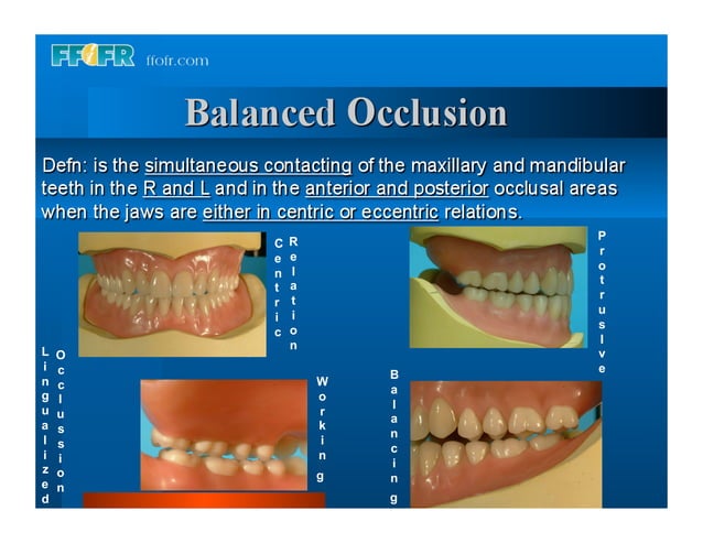 10.maxillomandibular relation records | PPT