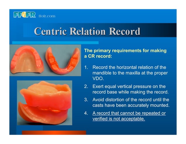 10.maxillomandibular relation records | PPT