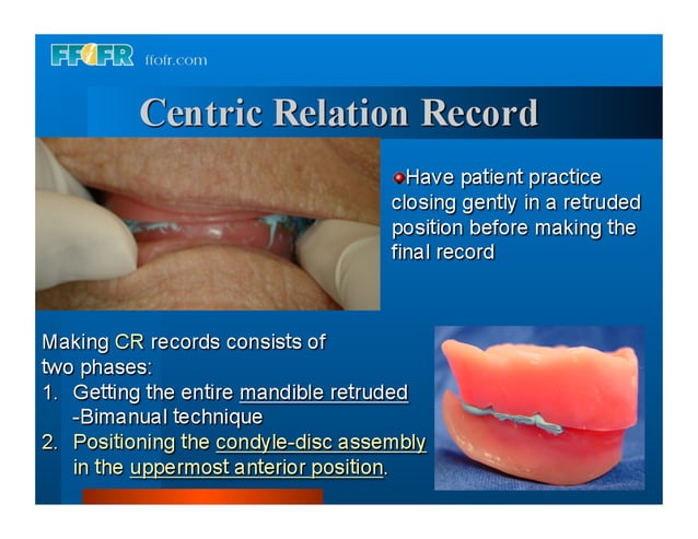 10.maxillomandibular relation records | PPT