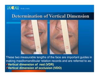 10.maxillomandibular relation records | PPT