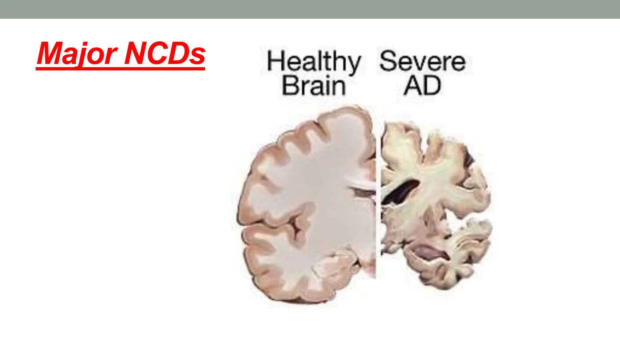 10-neurocognitive disorders.ppt