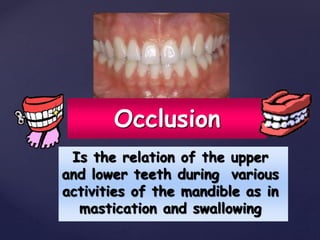 Occlusion | PPTX