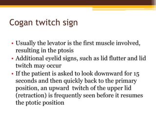 10-Ocular Myesthenia.pptx