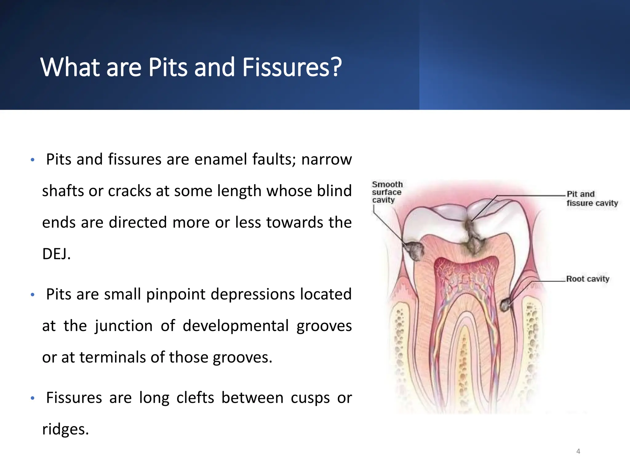 PIT AND FISSURE SEALANTS | PPTX