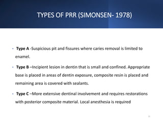 PIT AND FISSURE SEALANTS | PPTX