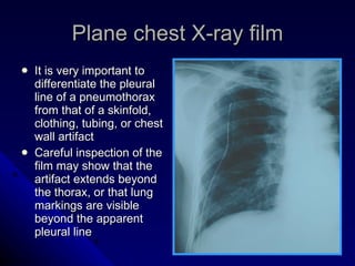 10.Pneumothorax | PPT