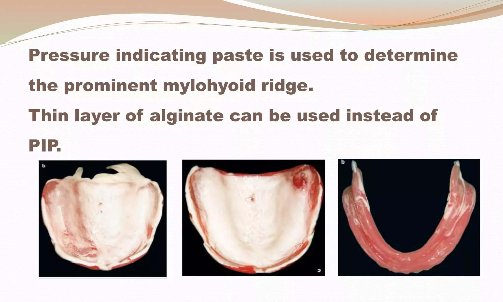10- Post Insertion Problems and Complaints -.pptx