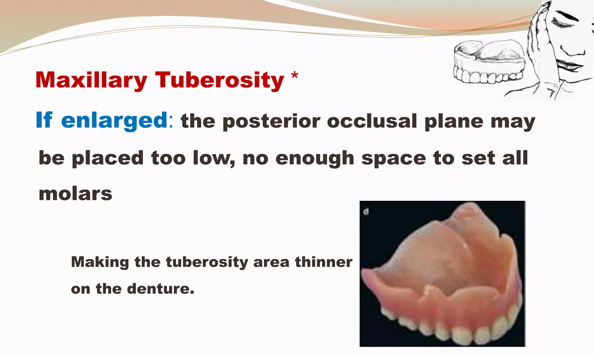 10- Post Insertion Problems and Complaints -.pptx
