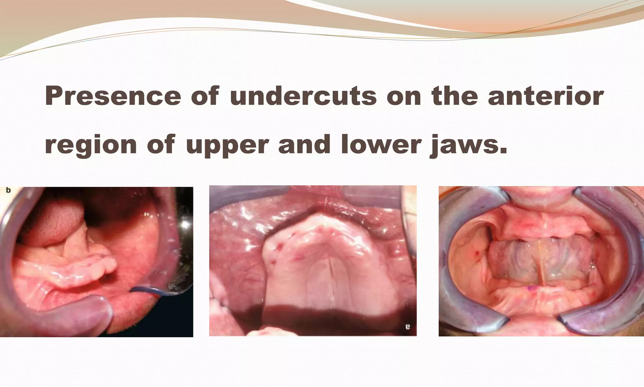 10- Post Insertion Problems and Complaints -.pptx