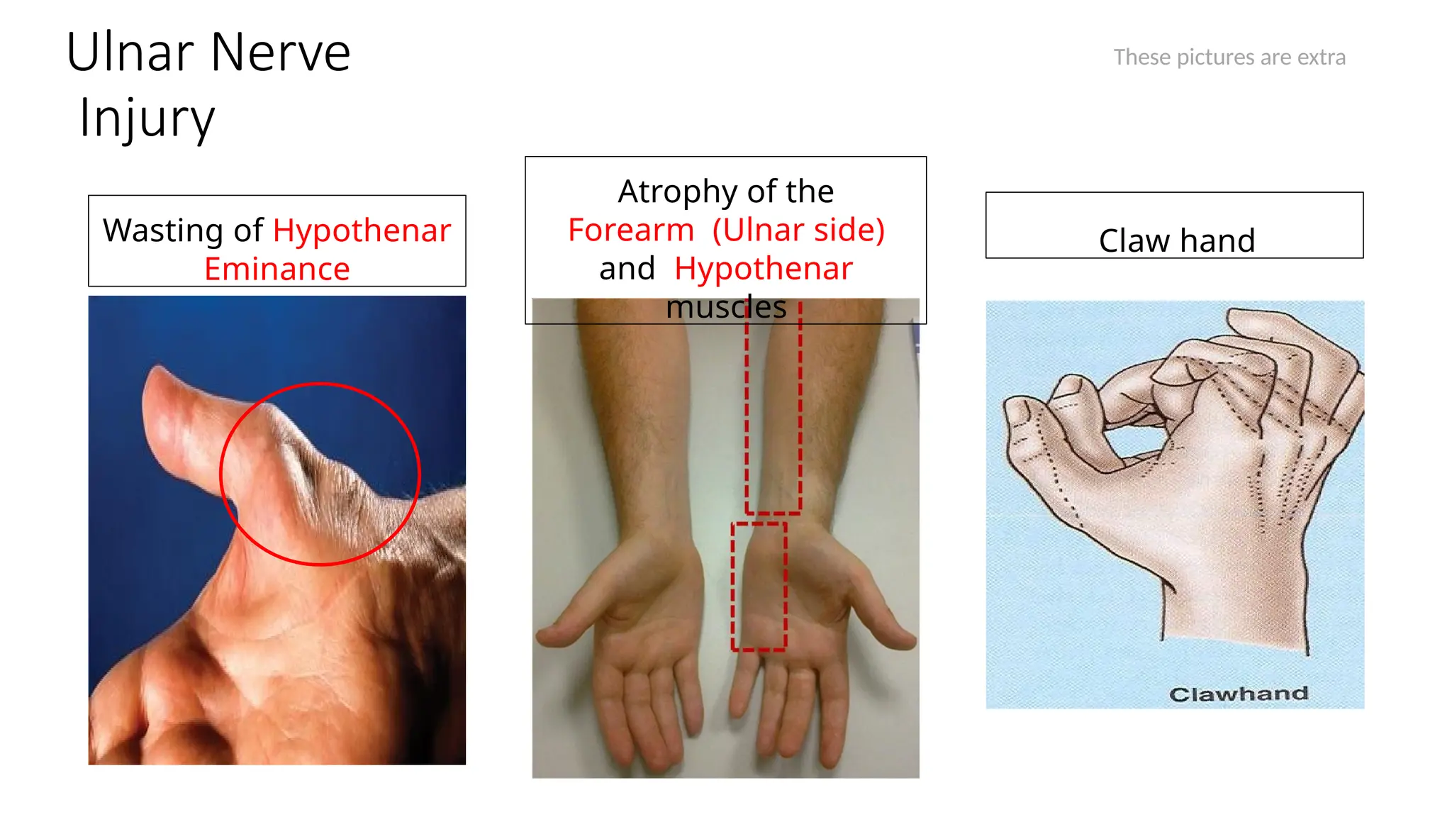 10-Radial and ulnar nerves anatomy course description | PPT