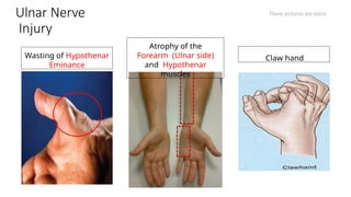 10-Radial and ulnar nerves anatomy course description | PPT