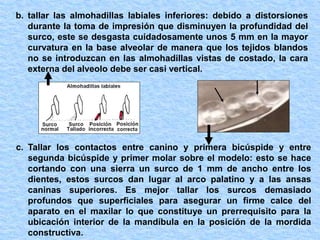 10- EL REGULADOR DE FUNCIÓN DE FRANKEL.ppt