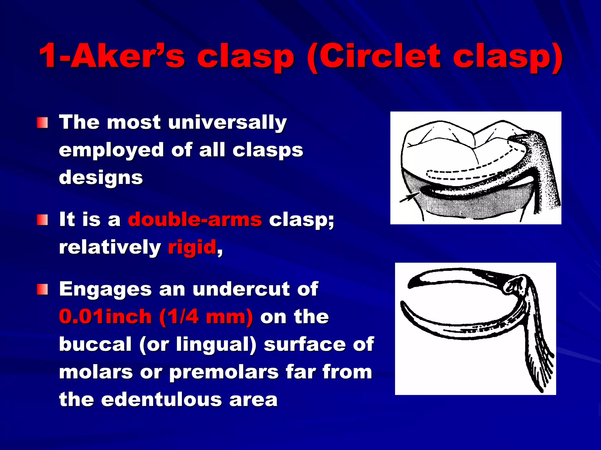 B- Retention of Removable Partial Dentures | PPT