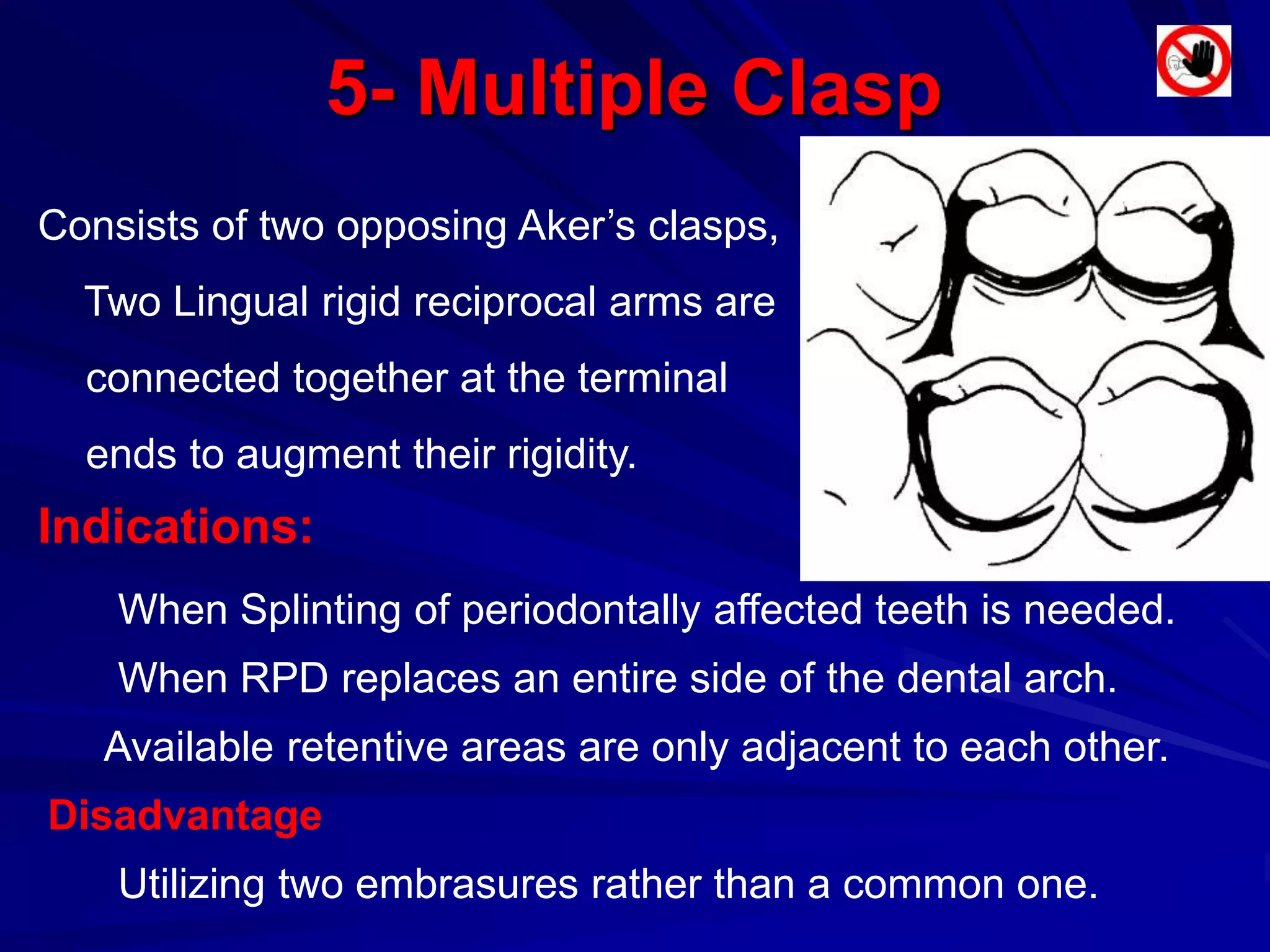 B- Retention of Removable Partial Dentures | PPT