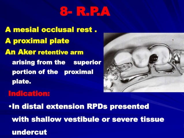 B- Retention of Removable Partial Dentures | PPT | Oral care | Personal ...