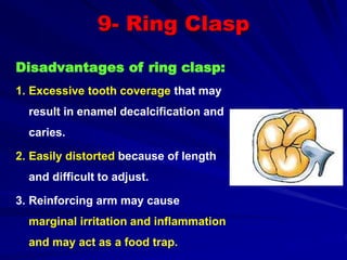 B- Retention of Removable Partial Dentures | PPT