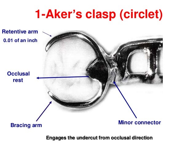 B- Retention of Removable Partial Dentures