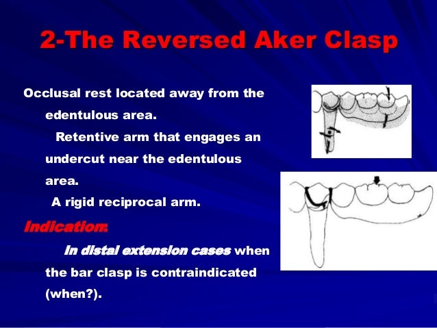 B- Retention of Removable Partial Dentures