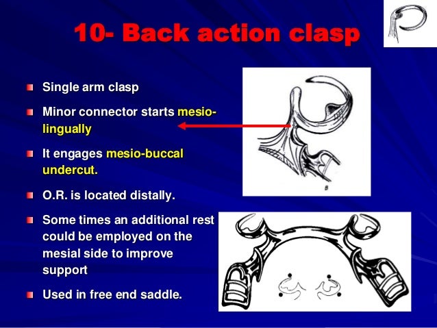 B- Retention of Removable Partial Dentures