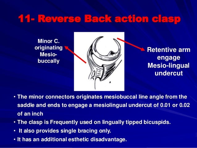 B- Retention of Removable Partial Dentures