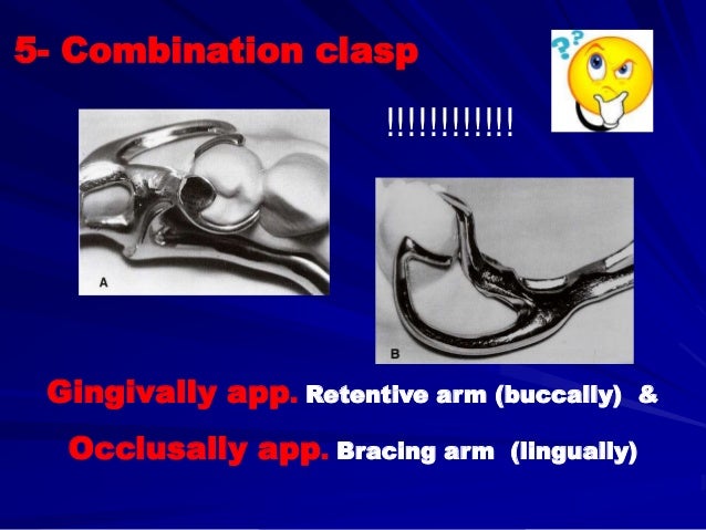 B- Retention of Removable Partial Dentures