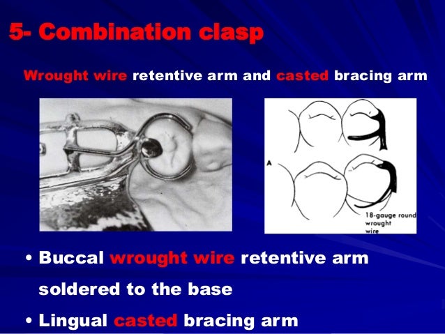 B- Retention of Removable Partial Dentures