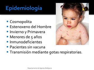 10. sarampion | PPT
