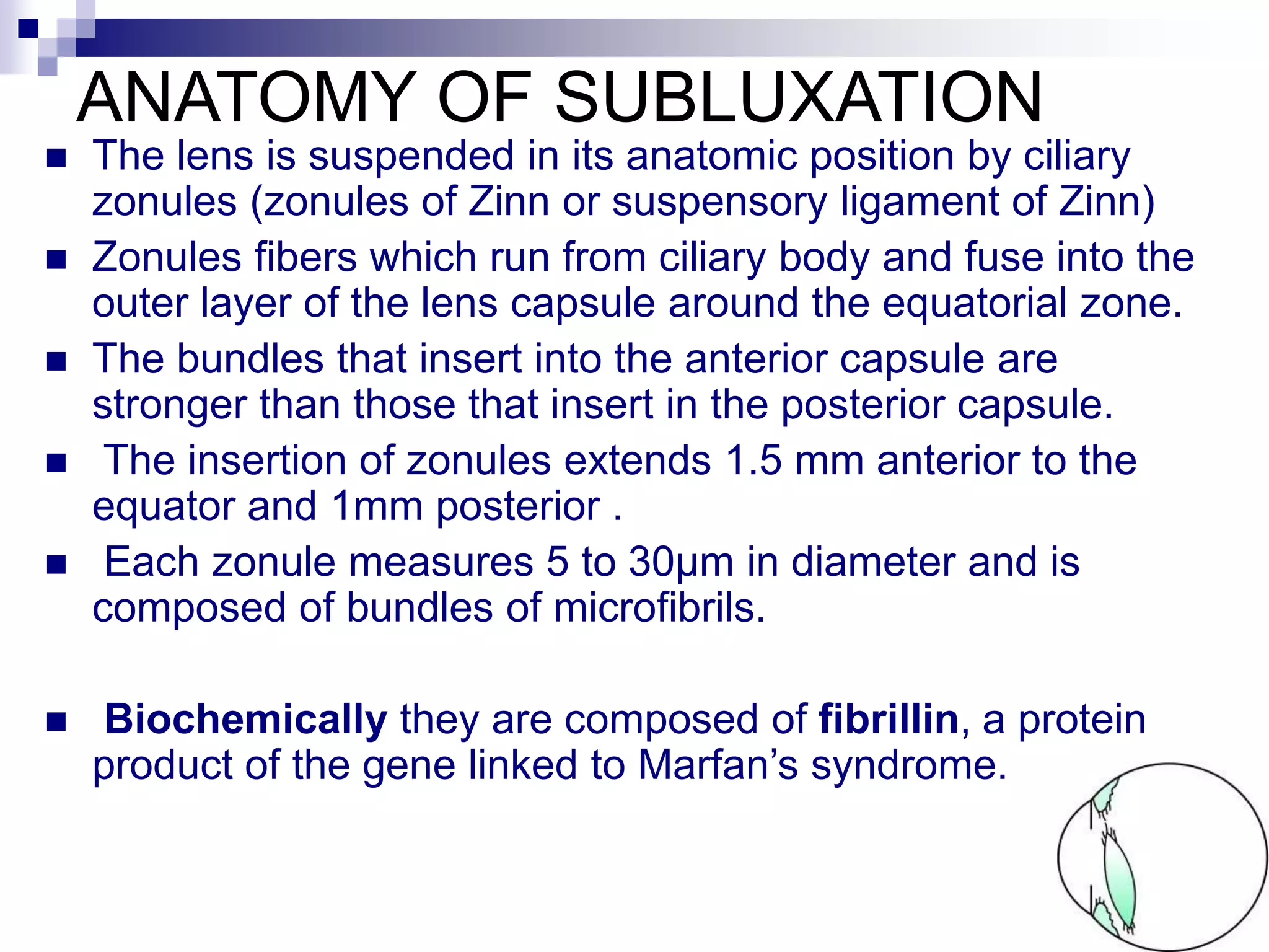 10-subluxated-lens.ppt