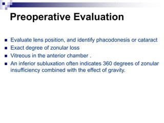 10-subluxated-lens.ppt