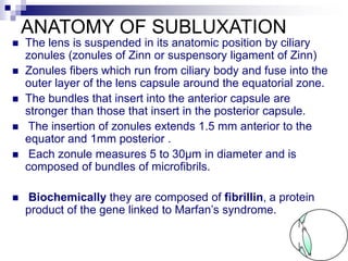 10-subluxated-lens.ppt