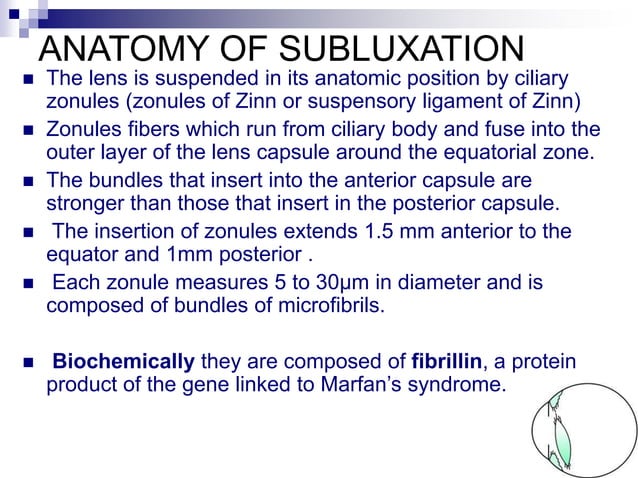 10-subluxated-lens.ppt | Eye and Vision Conditions | Diseases and ...