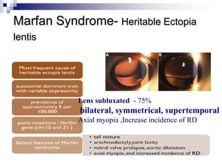 10-subluxated-lens.ppt