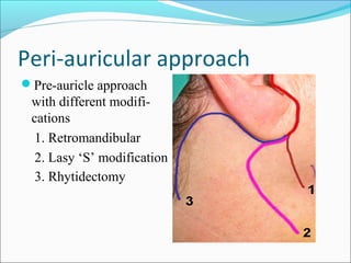 surgical approaches to the mandibular condyle | PPT