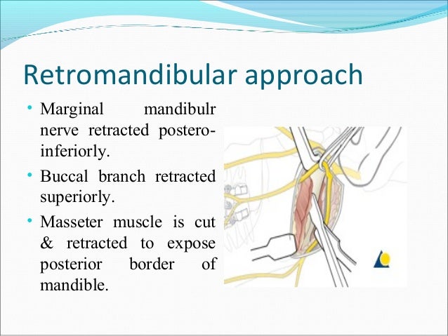 surgical approaches to the mandibular condyle