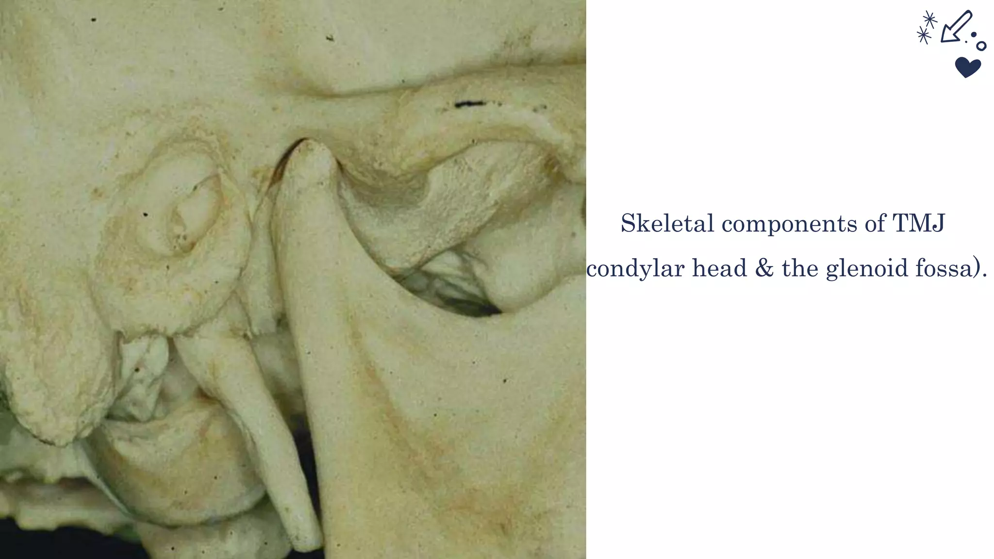 Temporomandibular joint disorders | PPTX