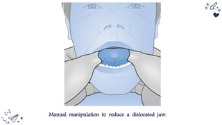 Temporomandibular joint disorders | PPTX
